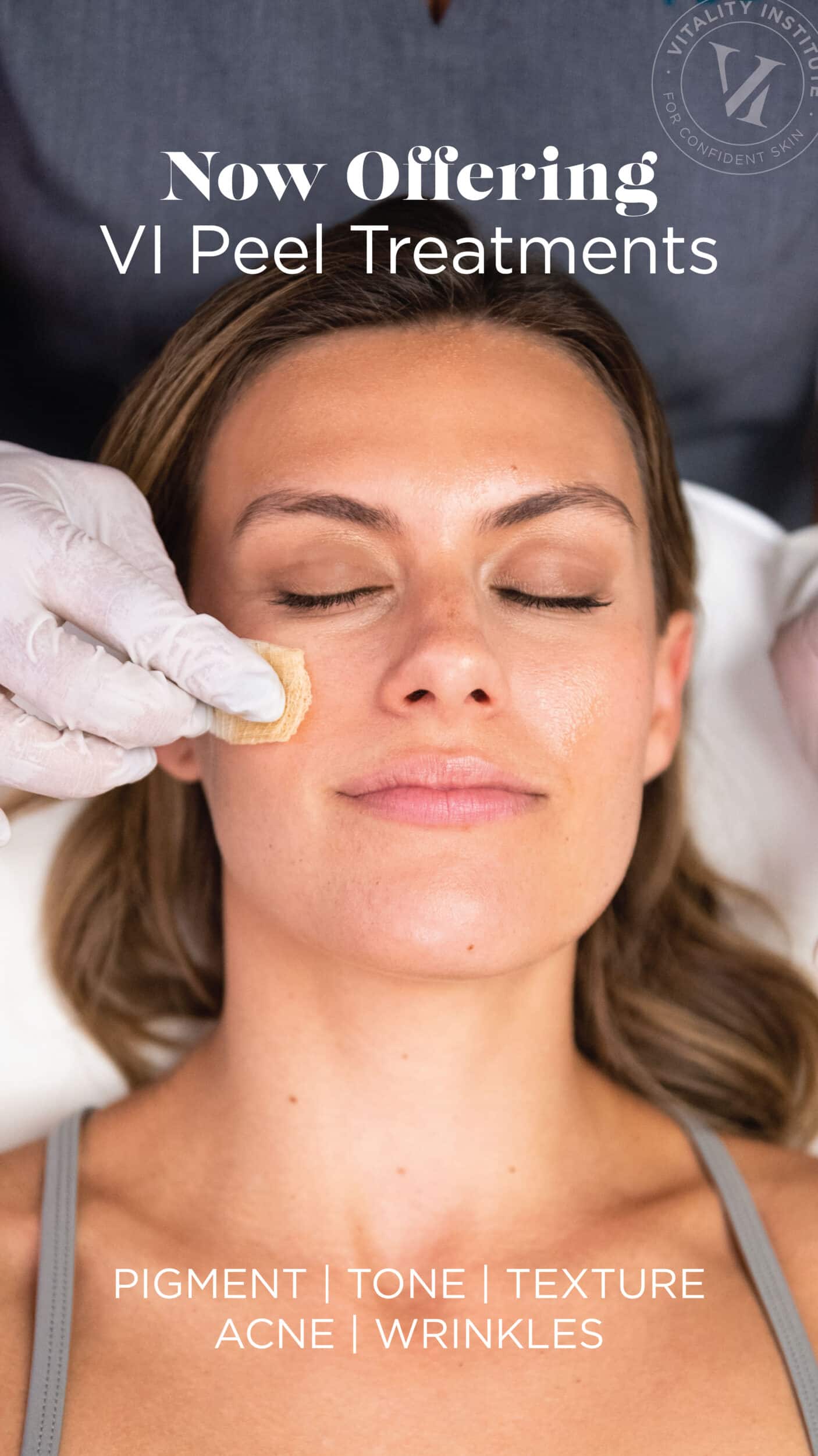 VI Peel® Precision Plus with Peptides - NeuroSpa
